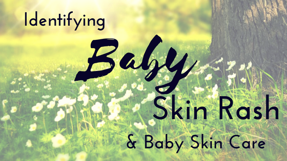 Baby Skin Rash- Identifying Baby Rash and Caring for Baby Skin